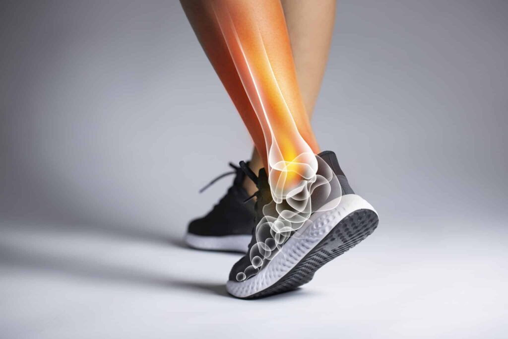 Deltoid Ligament Sprain - CARESPACE Health+Wellness