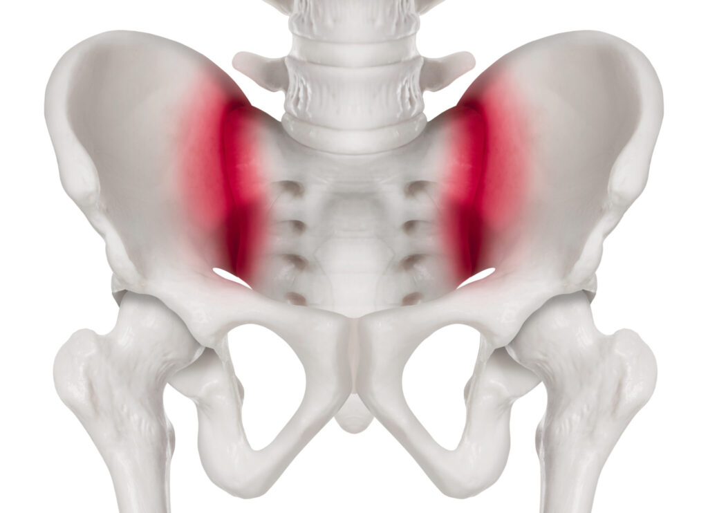 SI Joint Irritation - CARESPACE Health+Wellness